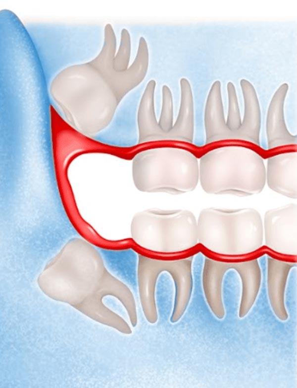 Cirugía Oral - Torremolinos | Dr. Carlos Moreno